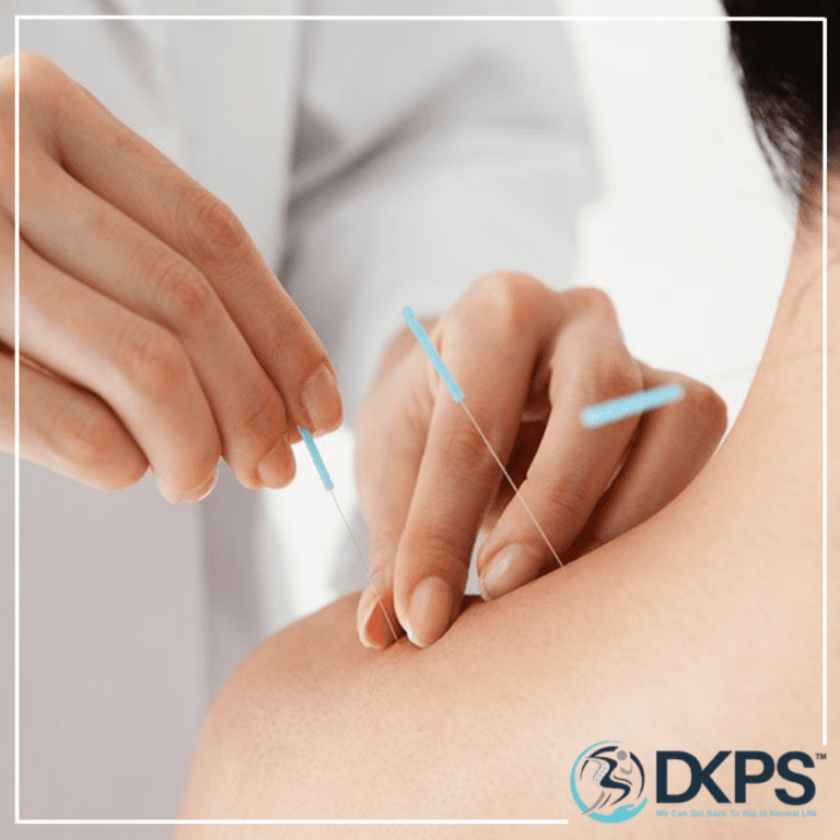 Needle Therapy for Back Pain - Drsinghphysiocare